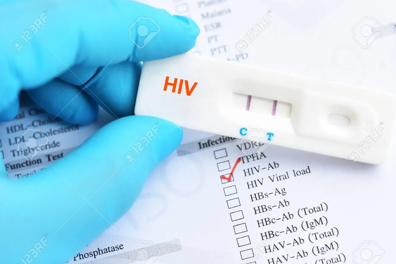 101 Myths: For HIV Test, You Must Know